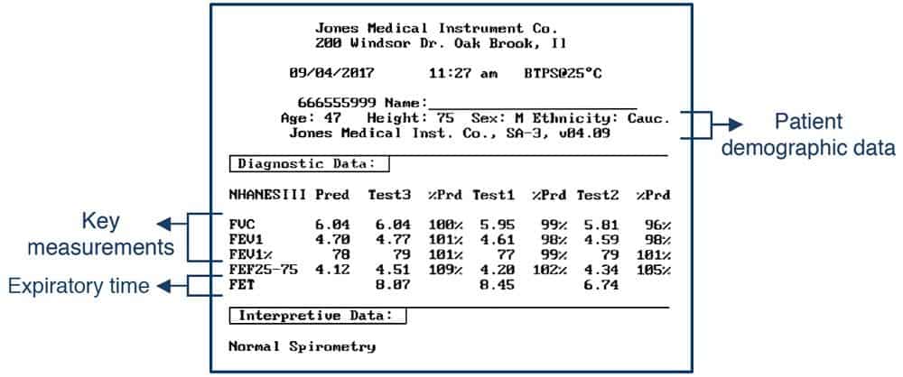 What is Spirometry? | Jones Medical